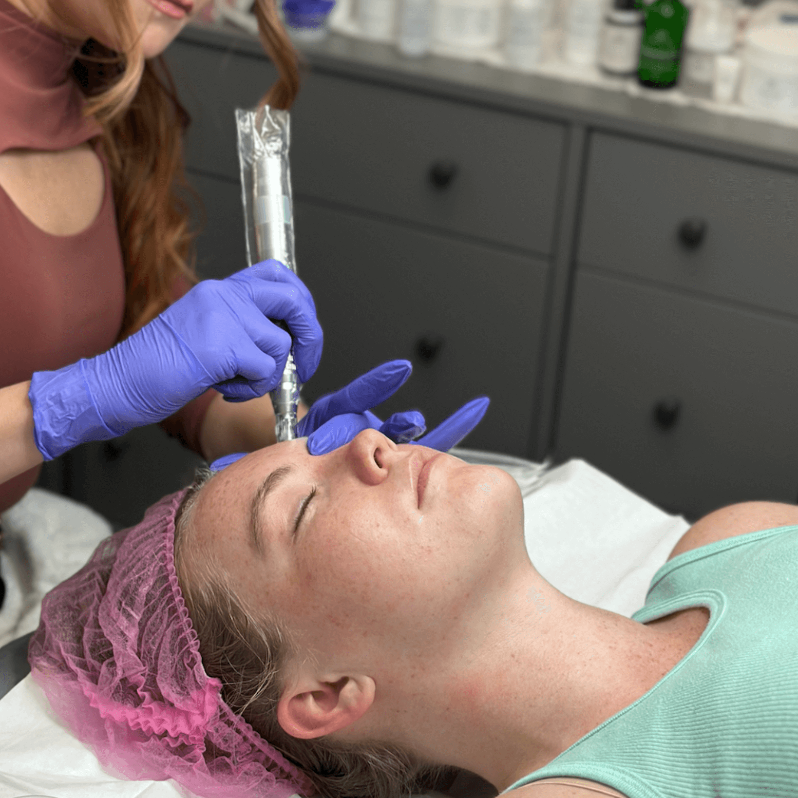 Collagen Induction Therapy (CIT) / Micro-needling + Nano-Infusion – The ...